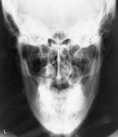 Textbook of Radiographic Positioning and Related Anatomy