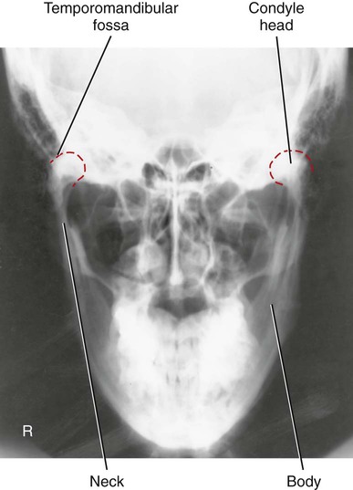 Textbook of Radiographic Positioning and Related Anatomy