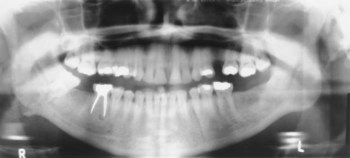 Textbook of Radiographic Positioning and Related Anatomy