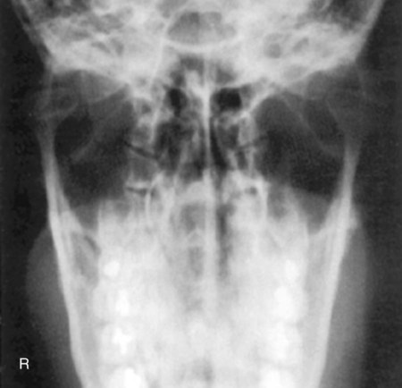 Textbook of Radiographic Positioning and Related Anatomy