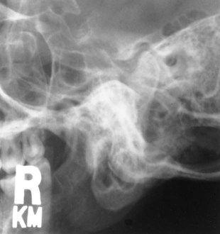 Textbook of Radiographic Positioning and Related Anatomy