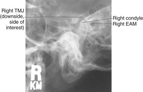 Textbook of Radiographic Positioning and Related Anatomy