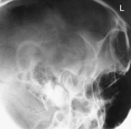 Textbook of Radiographic Positioning and Related Anatomy