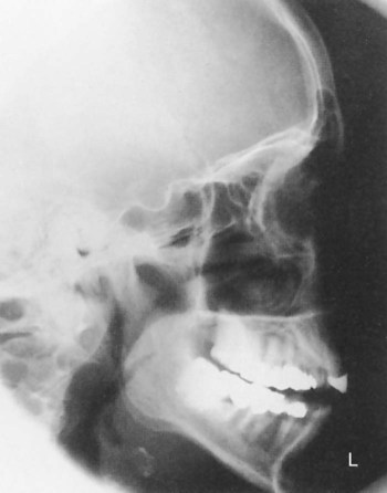 Textbook of Radiographic Positioning and Related Anatomy