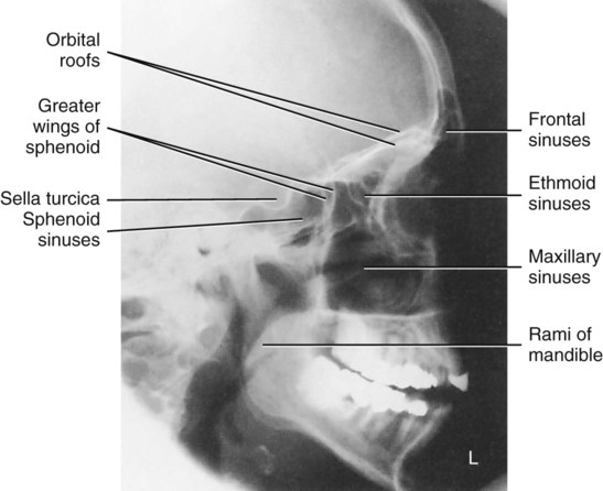Textbook of Radiographic Positioning and Related Anatomy