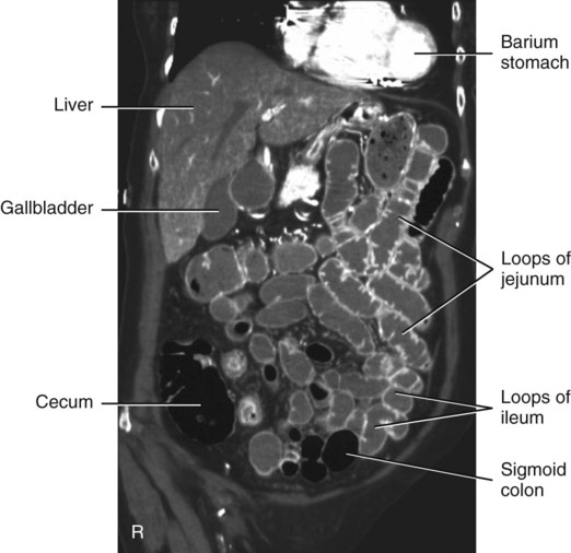 Textbook of Radiographic Positioning and Related Anatomy