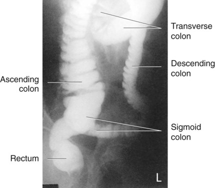 Textbook of Radiographic Positioning and Related Anatomy