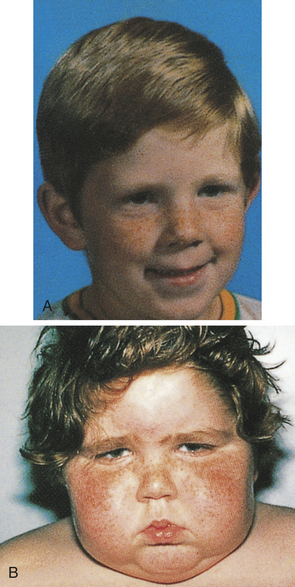 Pathophysiology: The Biologic Basis for Disease in Adults and Children