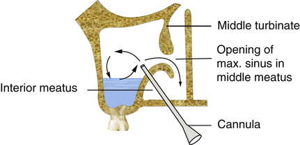 Diseases of Ear, Nose and Throat & Head and Neck Surgery