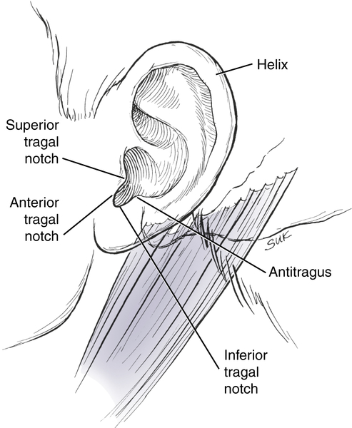 Principles and Practice of Radiation Therapy