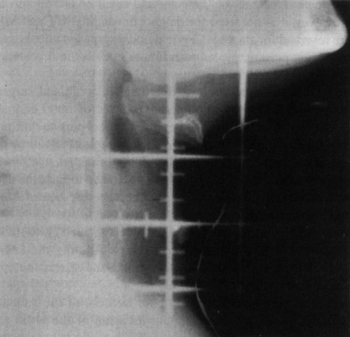 Principles and Practice of Radiation Therapy