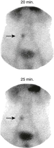 Nelson Textbook of Pediatrics