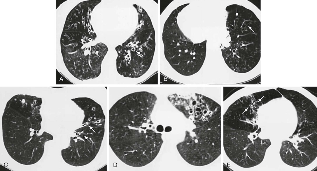 Nelson Textbook of Pediatrics