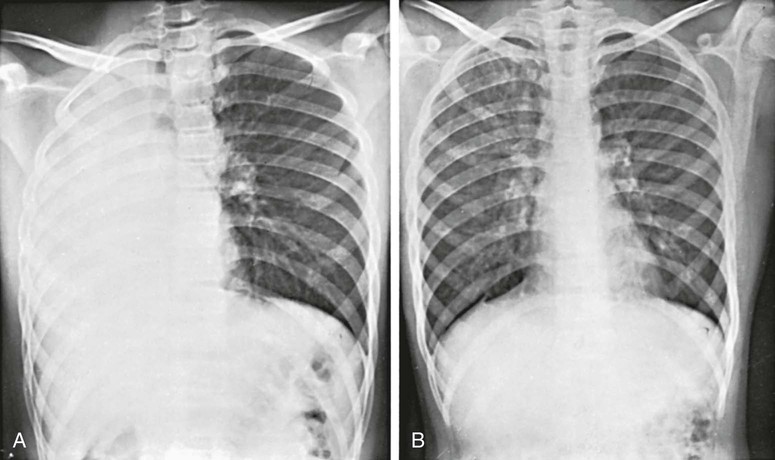 Nelson Textbook of Pediatrics
