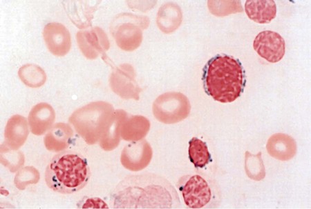 Nelson Textbook of Pediatrics