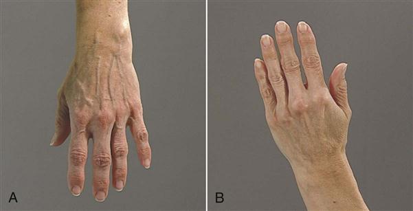 Seidel's Guide to Physical Examination