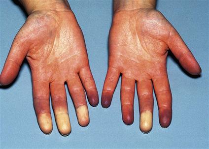 Seidel's Guide to Physical Examination