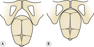 The female pelvis and the reproductive organs