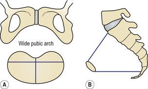 The female pelvis and the reproductive organs