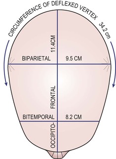 Malpositions of the occiput and malpresentations
