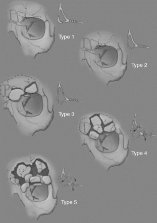 Plastic Surgery Secrets Plus