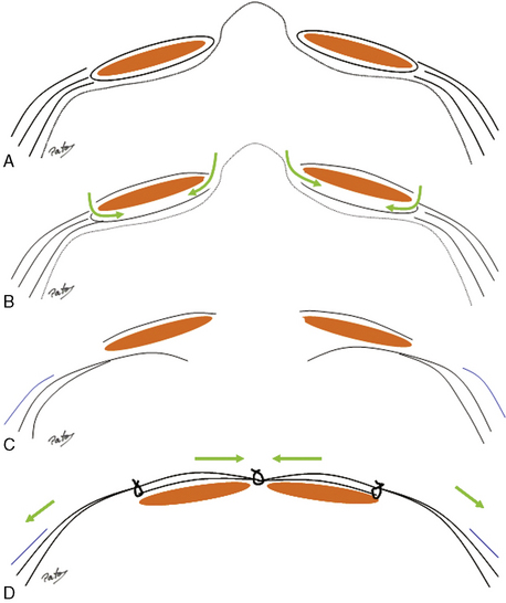 Plastic Surgery Secrets Plus
