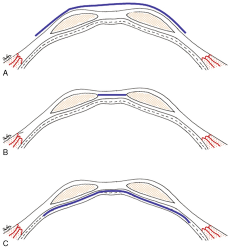 Plastic Surgery Secrets Plus