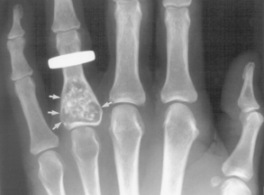 Plastic Surgery Secrets Plus