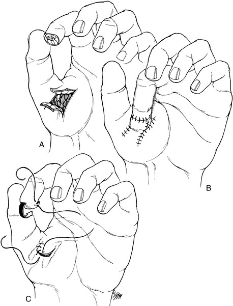 Plastic Surgery Secrets Plus