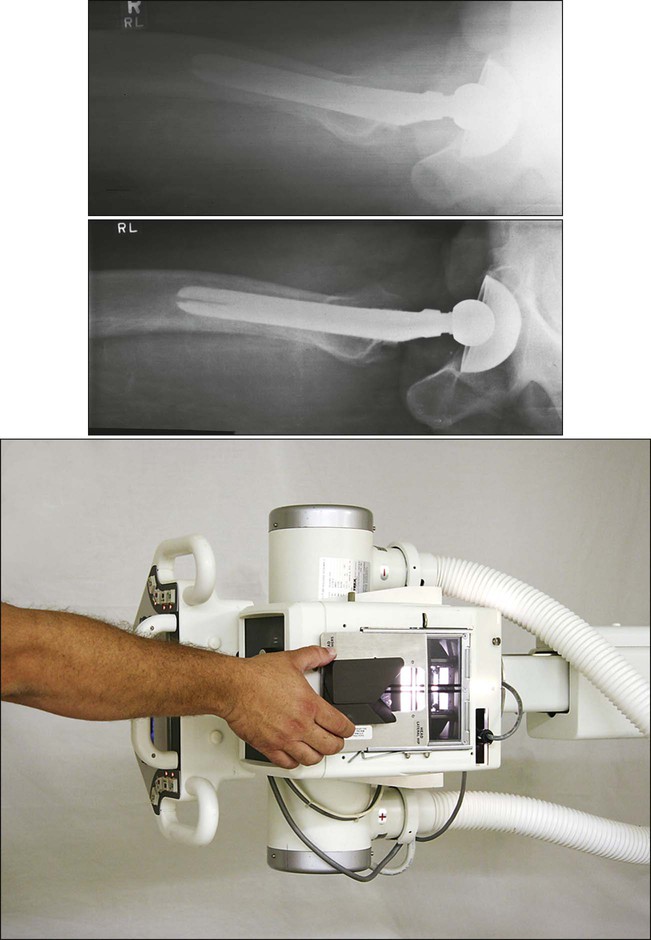 Merrill's Atlas of Radiographic Positioning & Procedures