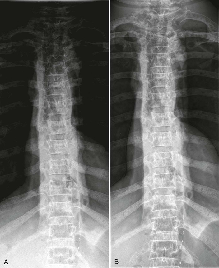 Merrill's Atlas of Radiographic Positioning & Procedures