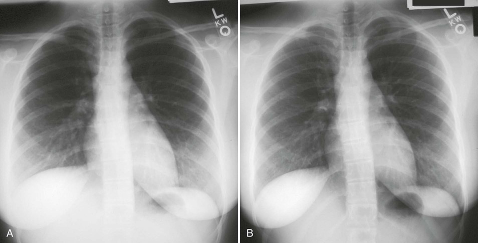 Merrill's Atlas of Radiographic Positioning & Procedures