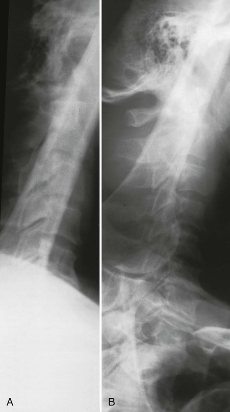 Merrill's Atlas of Radiographic Positioning & Procedures