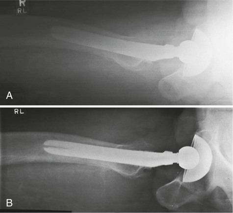 Merrill's Atlas of Radiographic Positioning & Procedures