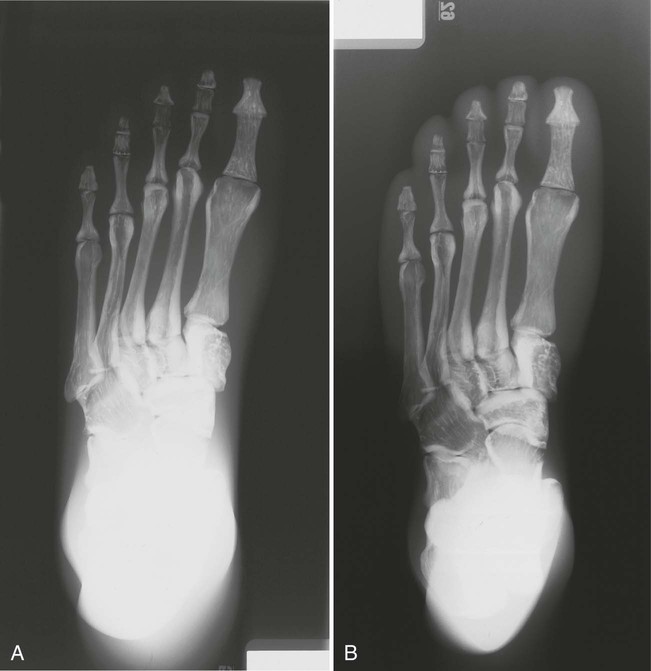 Merrill's Atlas of Radiographic Positioning & Procedures