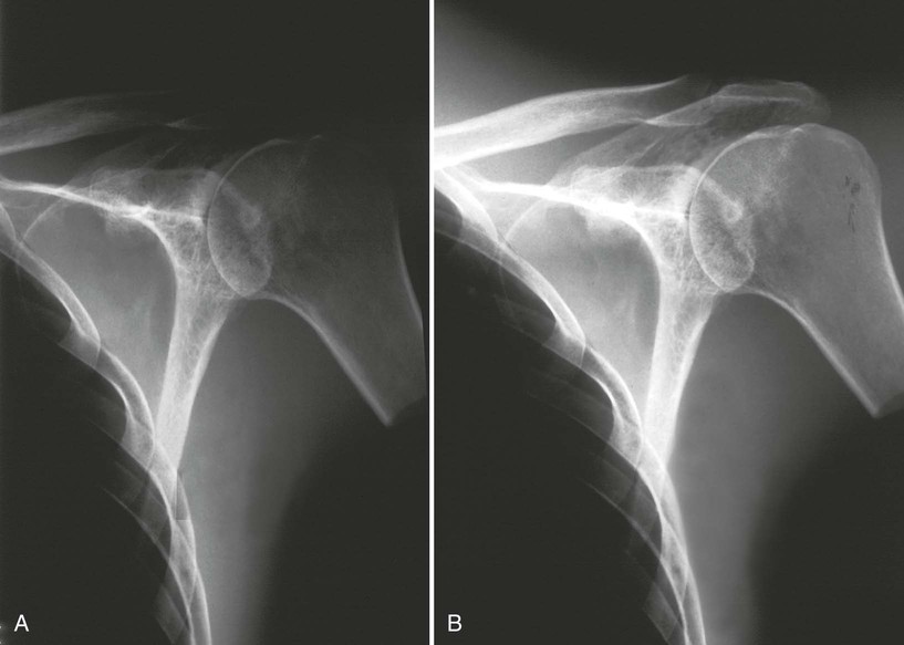 Merrill's Atlas of Radiographic Positioning & Procedures