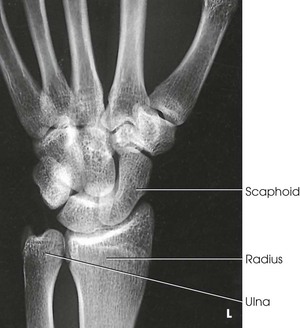 Merrill's Atlas of Radiographic Positioning & Procedures