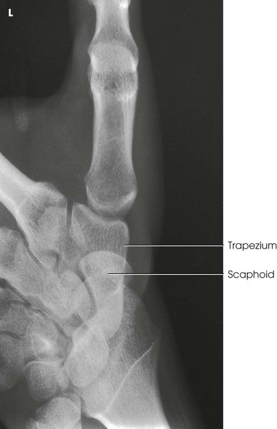 Merrill's Atlas of Radiographic Positioning & Procedures
