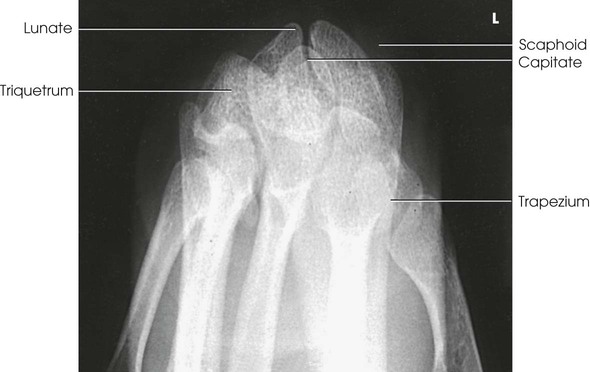 Merrill's Atlas of Radiographic Positioning & Procedures