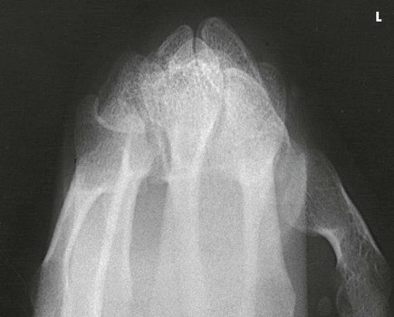 Merrill's Atlas of Radiographic Positioning & Procedures