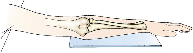 Merrill's Atlas of Radiographic Positioning & Procedures