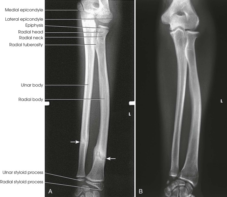 Merrill's Atlas of Radiographic Positioning & Procedures