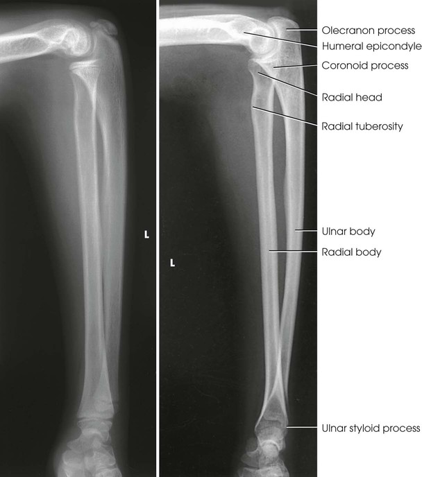 Merrill's Atlas of Radiographic Positioning & Procedures