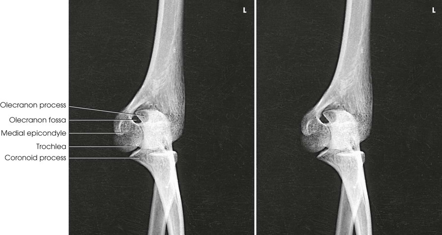 Merrill's Atlas of Radiographic Positioning & Procedures