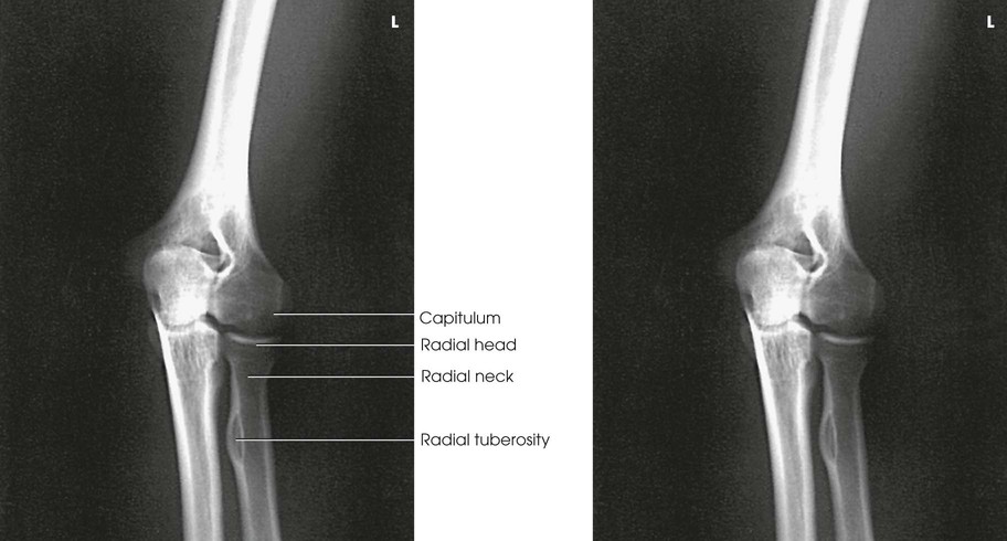 Merrill's Atlas of Radiographic Positioning & Procedures