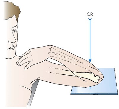 Merrill's Atlas of Radiographic Positioning & Procedures