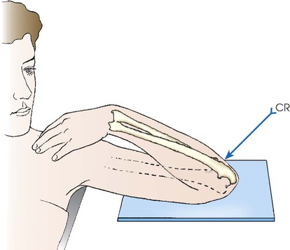 Merrill's Atlas of Radiographic Positioning & Procedures