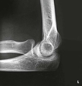 Merrill's Atlas of Radiographic Positioning & Procedures