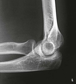 Merrill's Atlas of Radiographic Positioning & Procedures