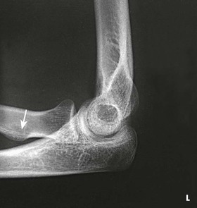 Merrill's Atlas of Radiographic Positioning & Procedures